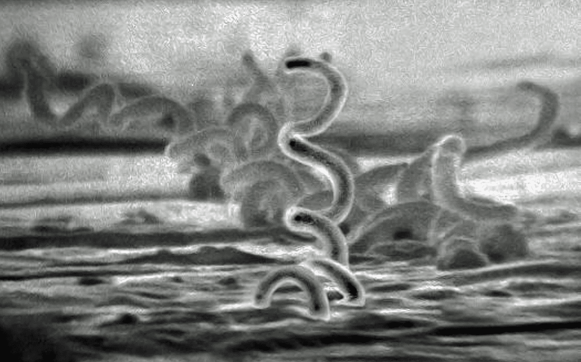 Core Concepts - Syphilis - Self-Study Lessons - National STD Curriculum