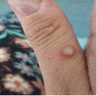 National STD Curriculum