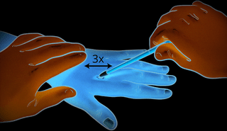 Core Concepts - Mpox - Self-Study Lessons - National STD Curriculum