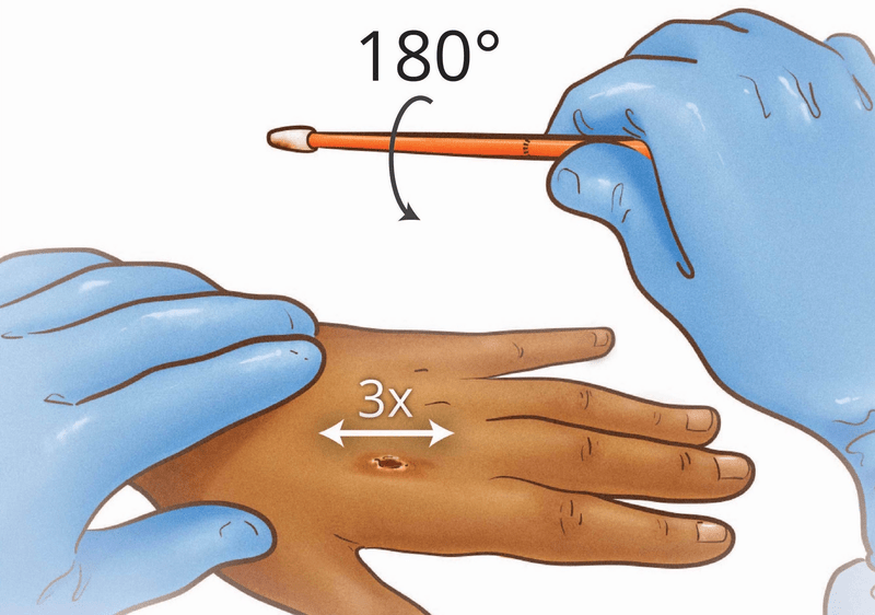 Core Concepts - Mpox - Self-Study Lessons - National STD Curriculum