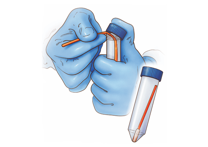 Core Concepts - Mpox - Self-Study Lessons - National STD Curriculum