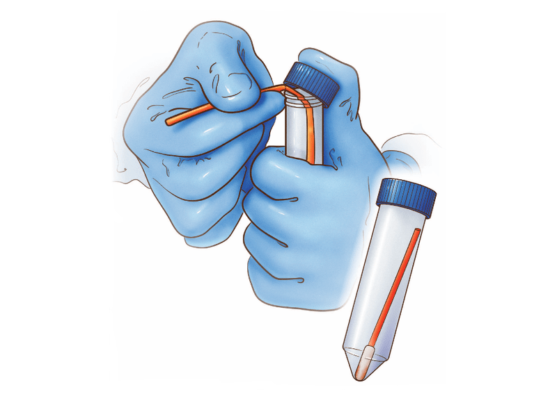 Core Concepts - Mpox - Self-Study Lessons - National STD Curriculum