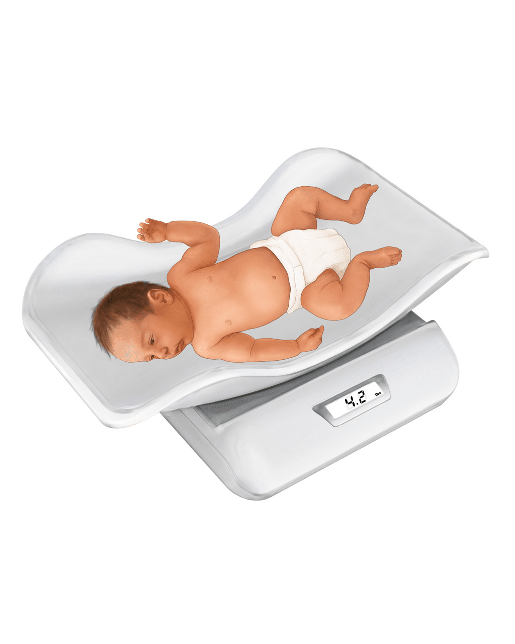 Infant - Congenital Syphilis - National STD Curriculum