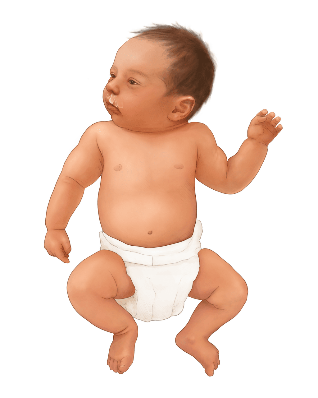Infant - Congenital Syphilis - National STD Curriculum